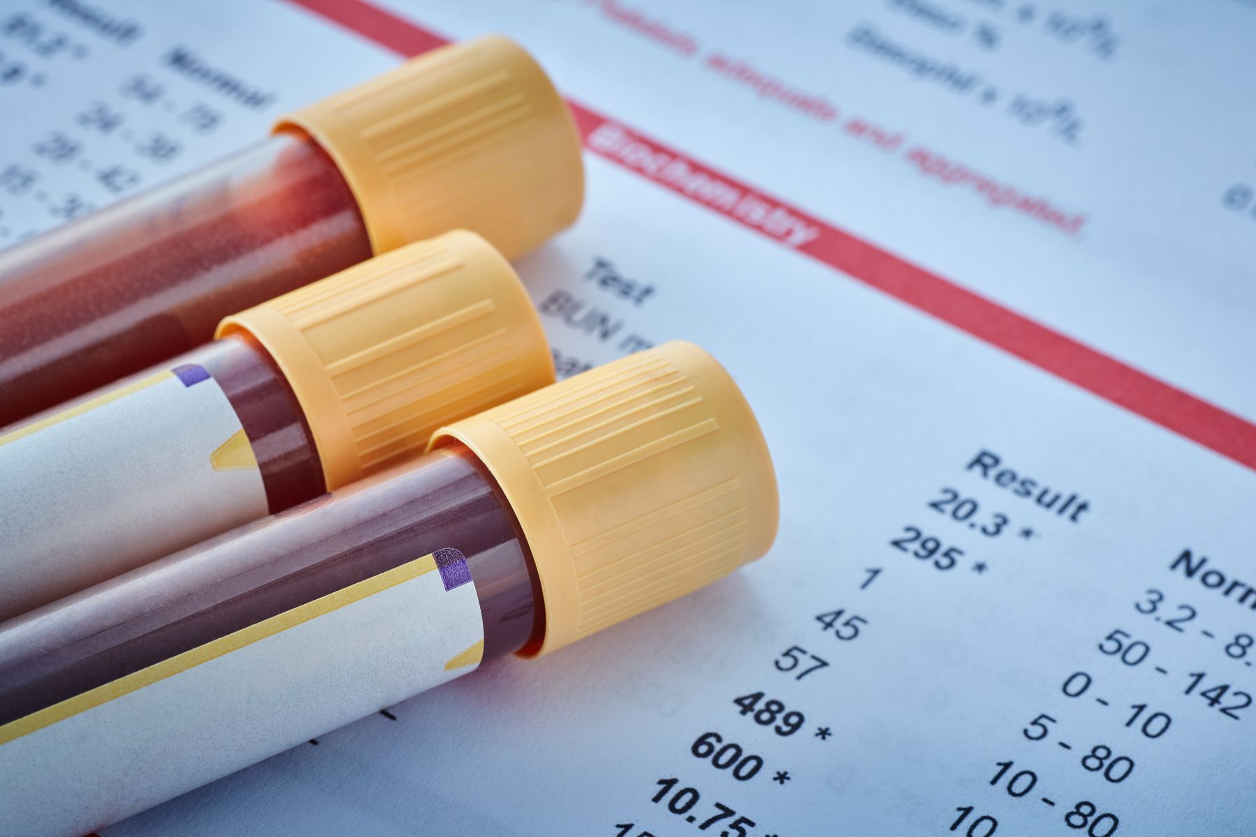 What Are Electrolyte Disturbances and Fluid Overload? - Northlake ...